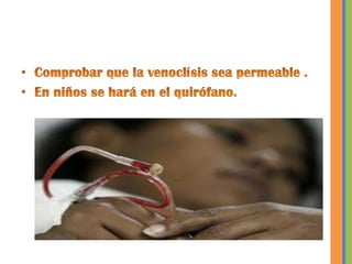 Preoperatorio mediato e inmediato | PPTX