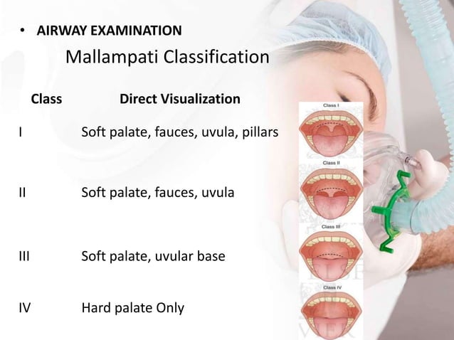 Preop eval and airway management | PPT