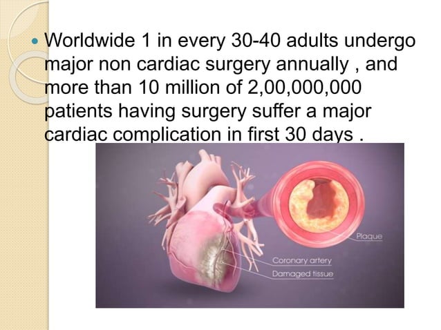 Preop evaluation of cardiac patient postd=ed for non cardiac surgery ...