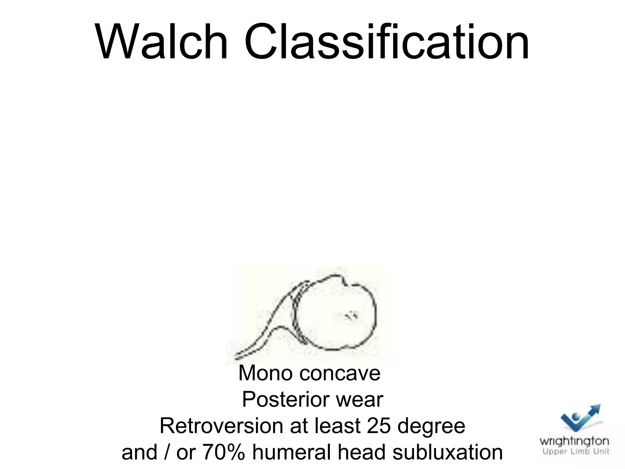 Pre op planning for shoulder arthroplasty | PPTX