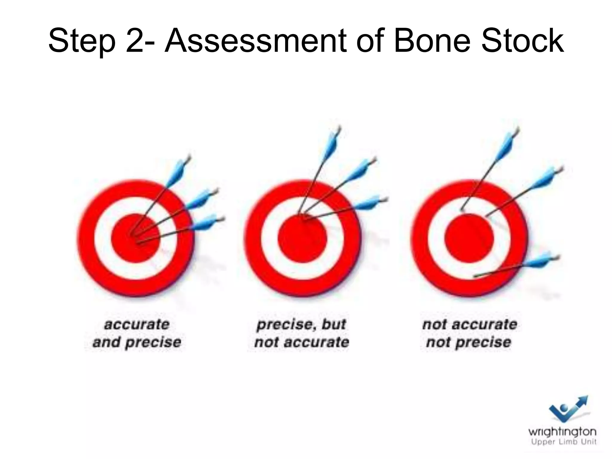 Pre op planning for shoulder arthroplasty | PPTX