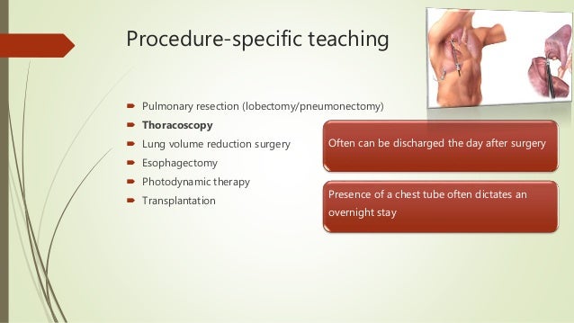 Preoperative preparation for thoracic surgery