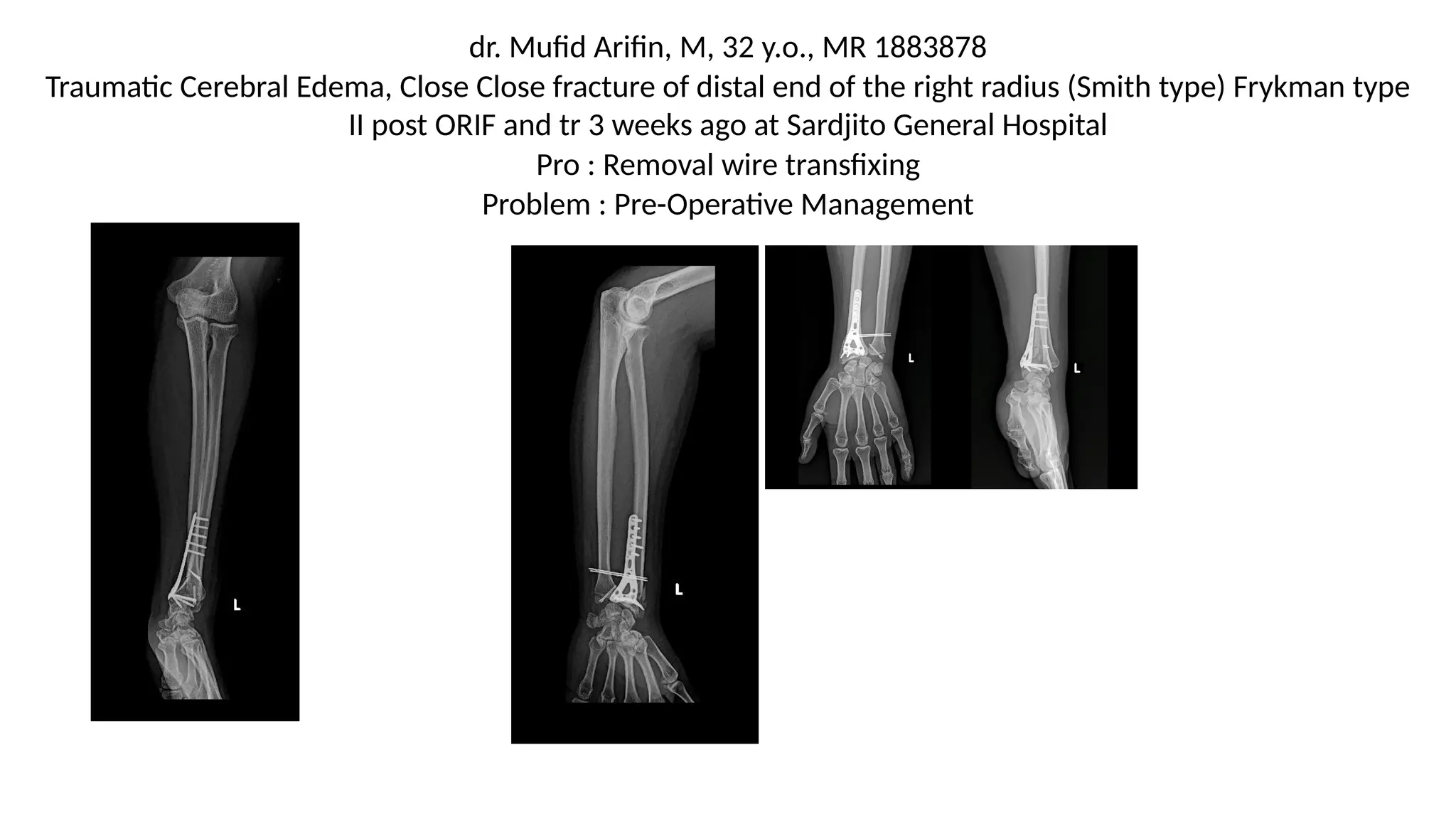 Pre OP stasis Hand 12 September Sept 2024 [Autosaved].pptx