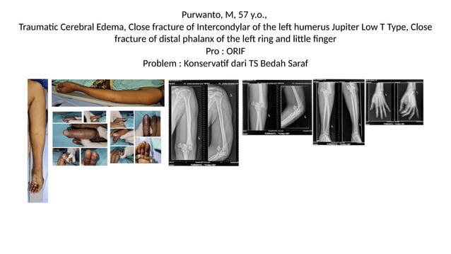 Pre OP stasis Hand 12 September Sept 2024 [Autosaved].pptx