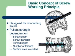 Novel Bone Anchor Concept for Osteoporotic Bone Tissue, 02/2003 | PPT