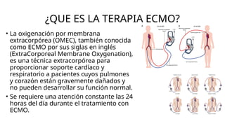 Preparación de pacientes para terapia ECMO | PPTX