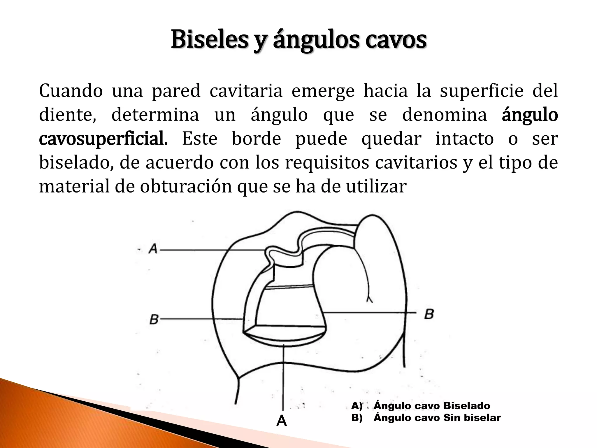 Preparacion de cavidades | PPTX