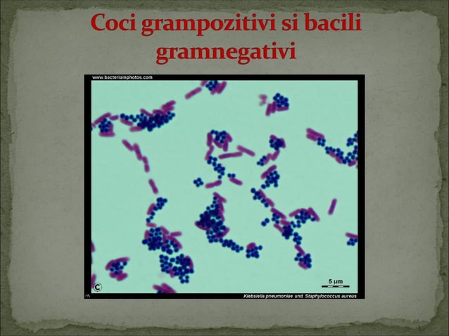 Preparate microscopice in analize medicale.ppt