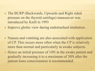 Preparation and conduct of anaesthesia in full stomach | PPTX