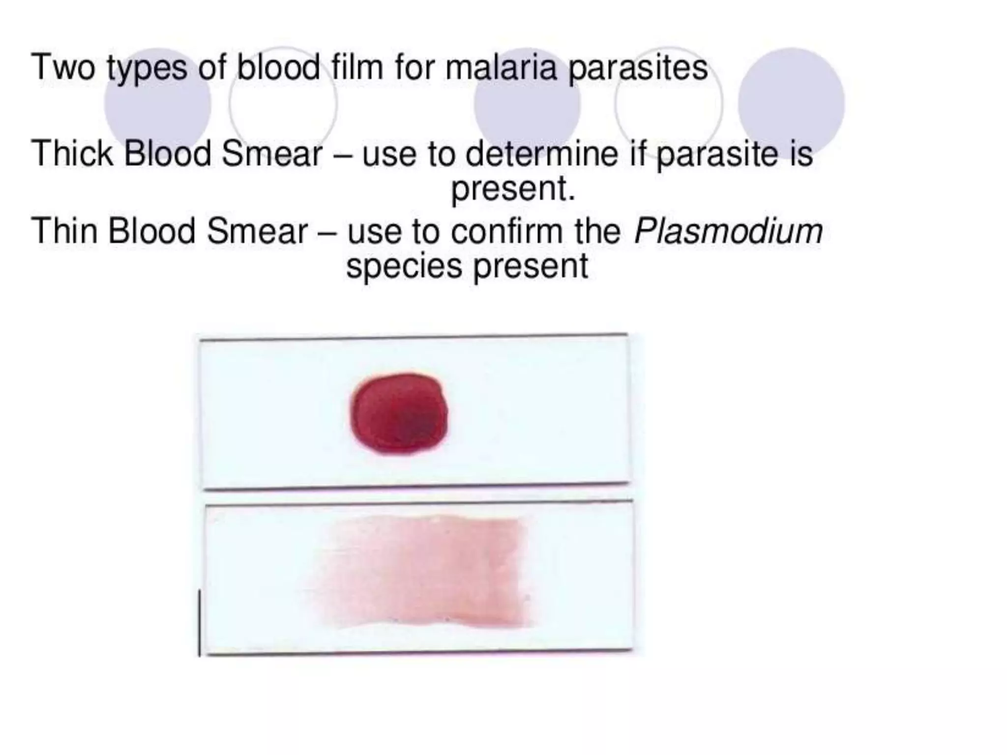 Preparation and staining of peripheral blood smear | PPTX