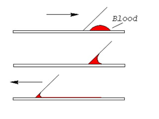 Preparation and staining of peripheral blood smear | PPTX