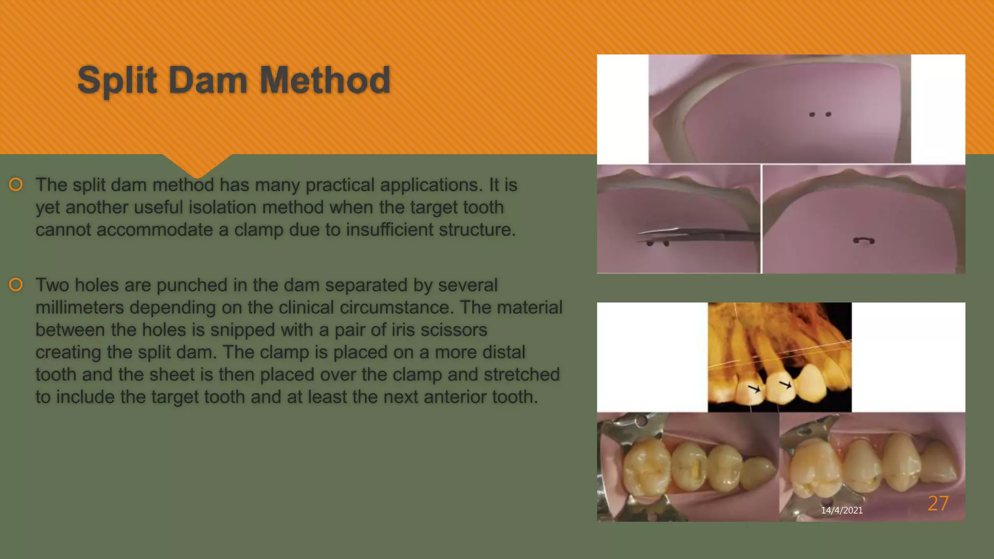 Preparation for treatment | PPTX