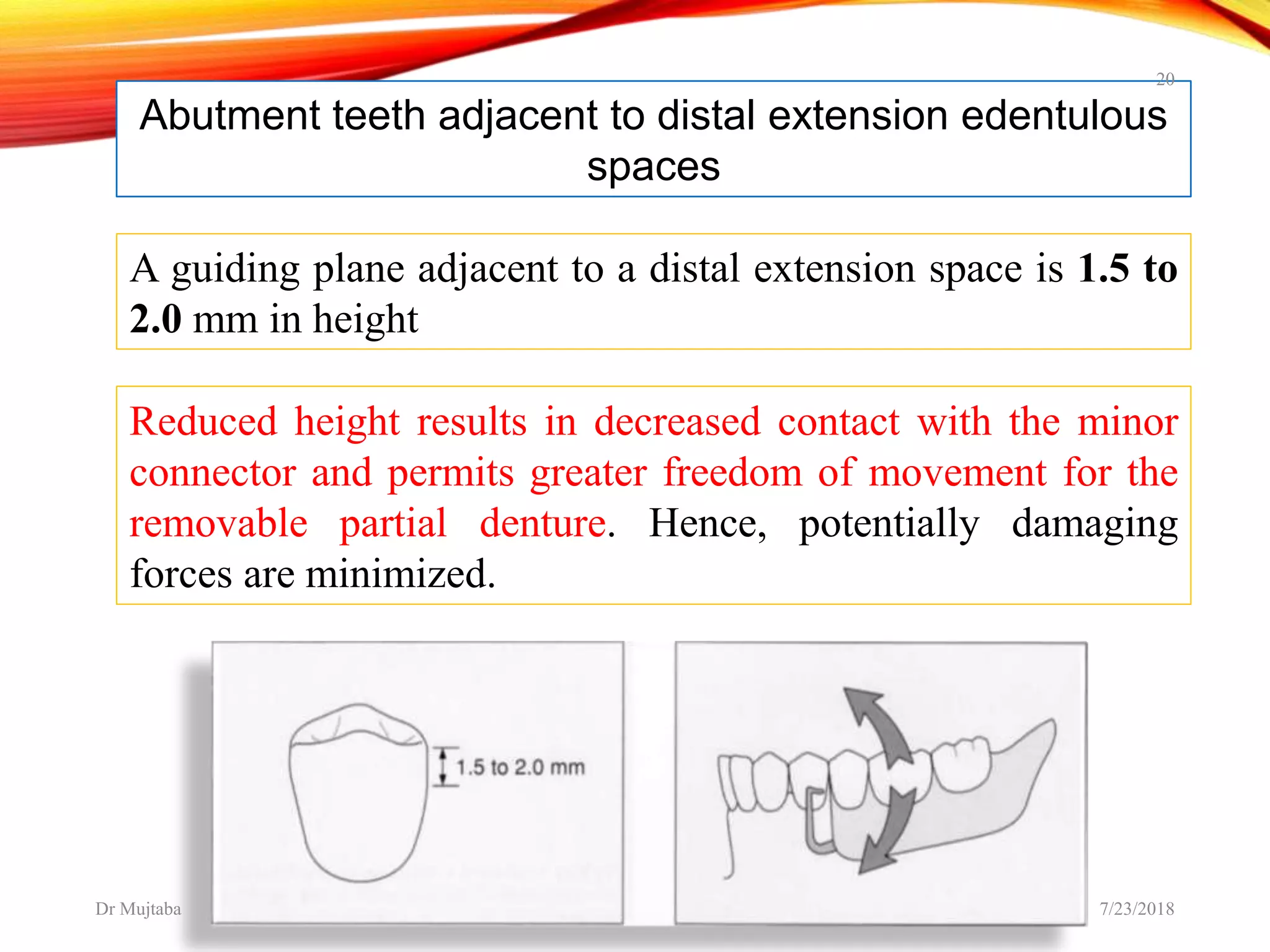 Preparation of abutment teeth | PPTX