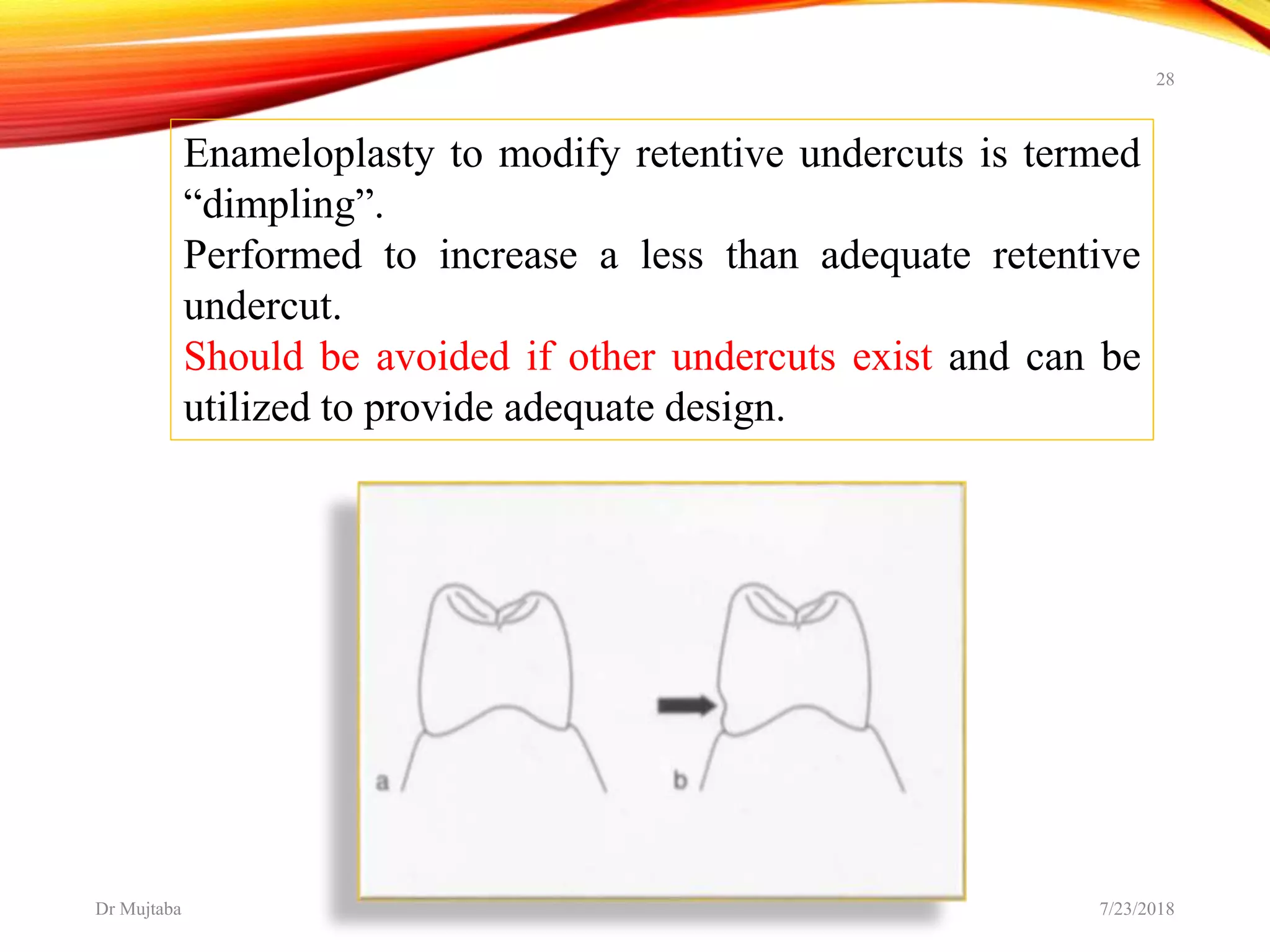 Preparation of abutment teeth | PPTX