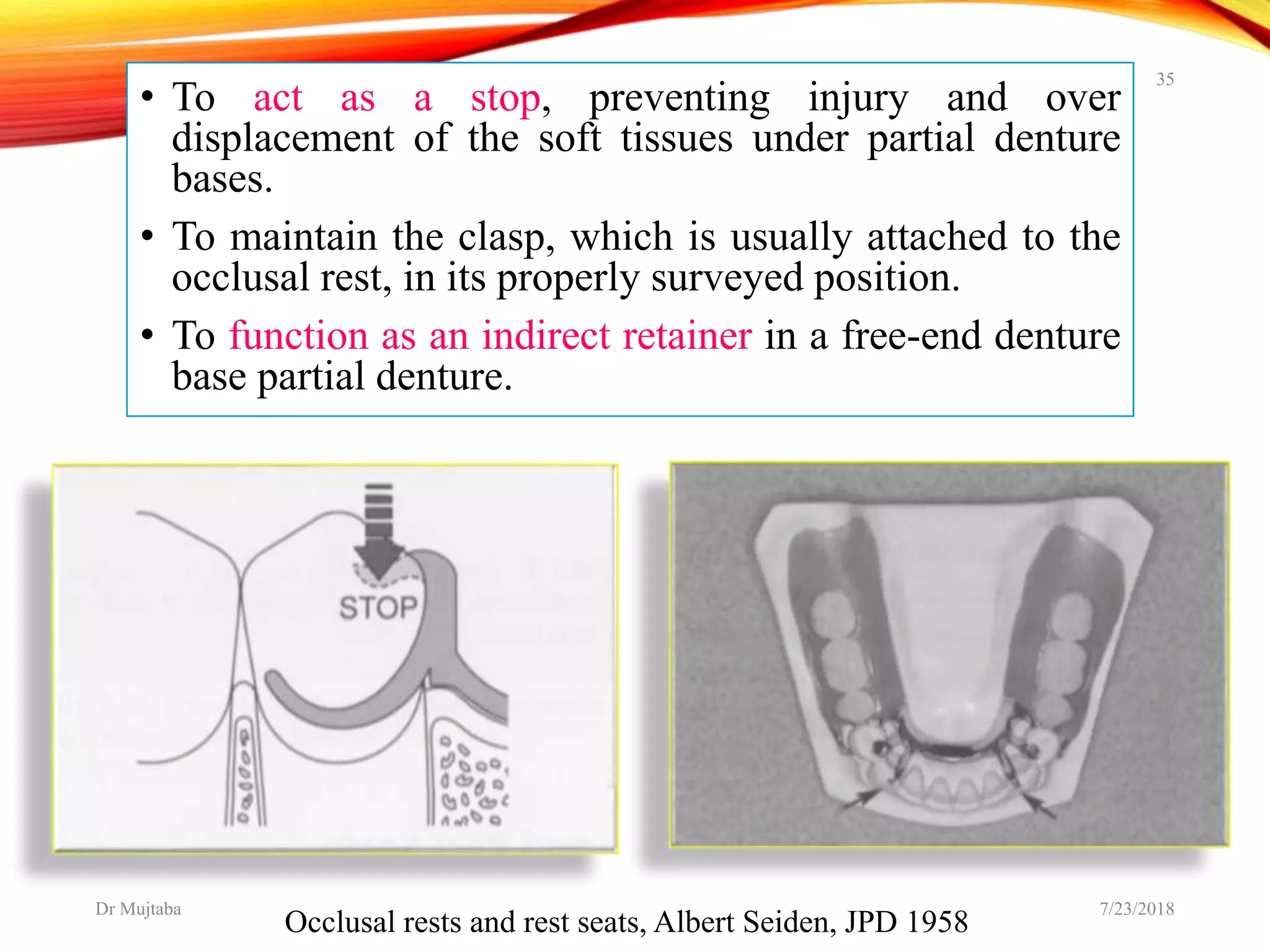 Preparation of abutment teeth | PPTX