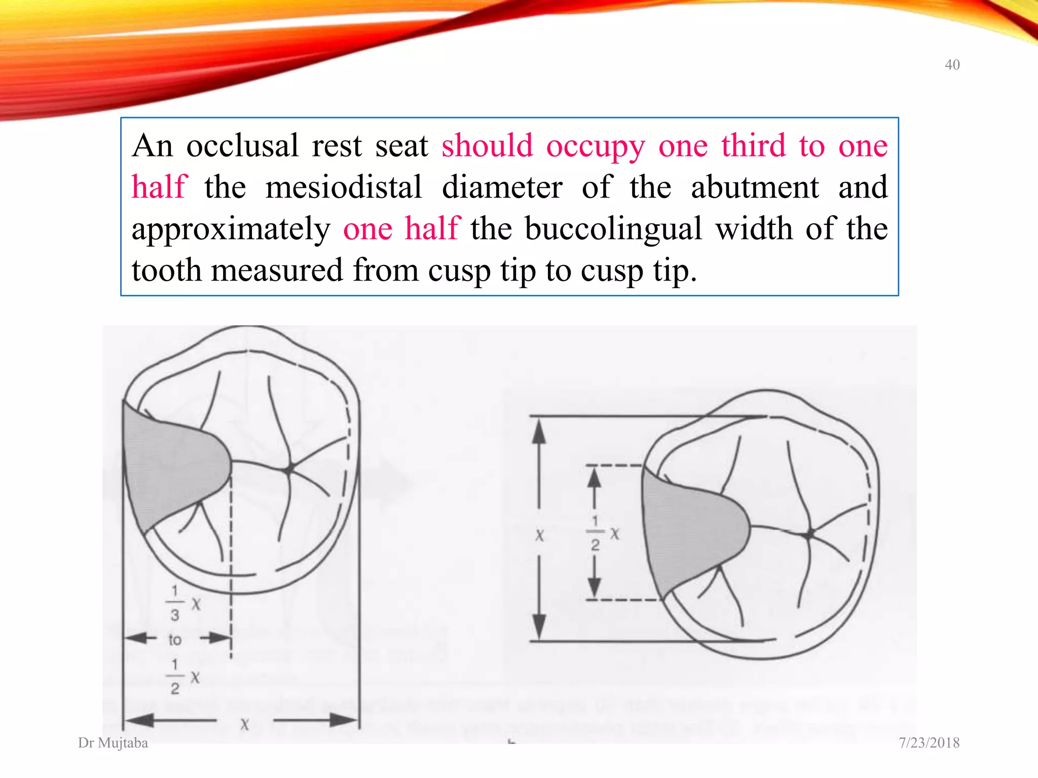 Preparation of abutment teeth | PPTX