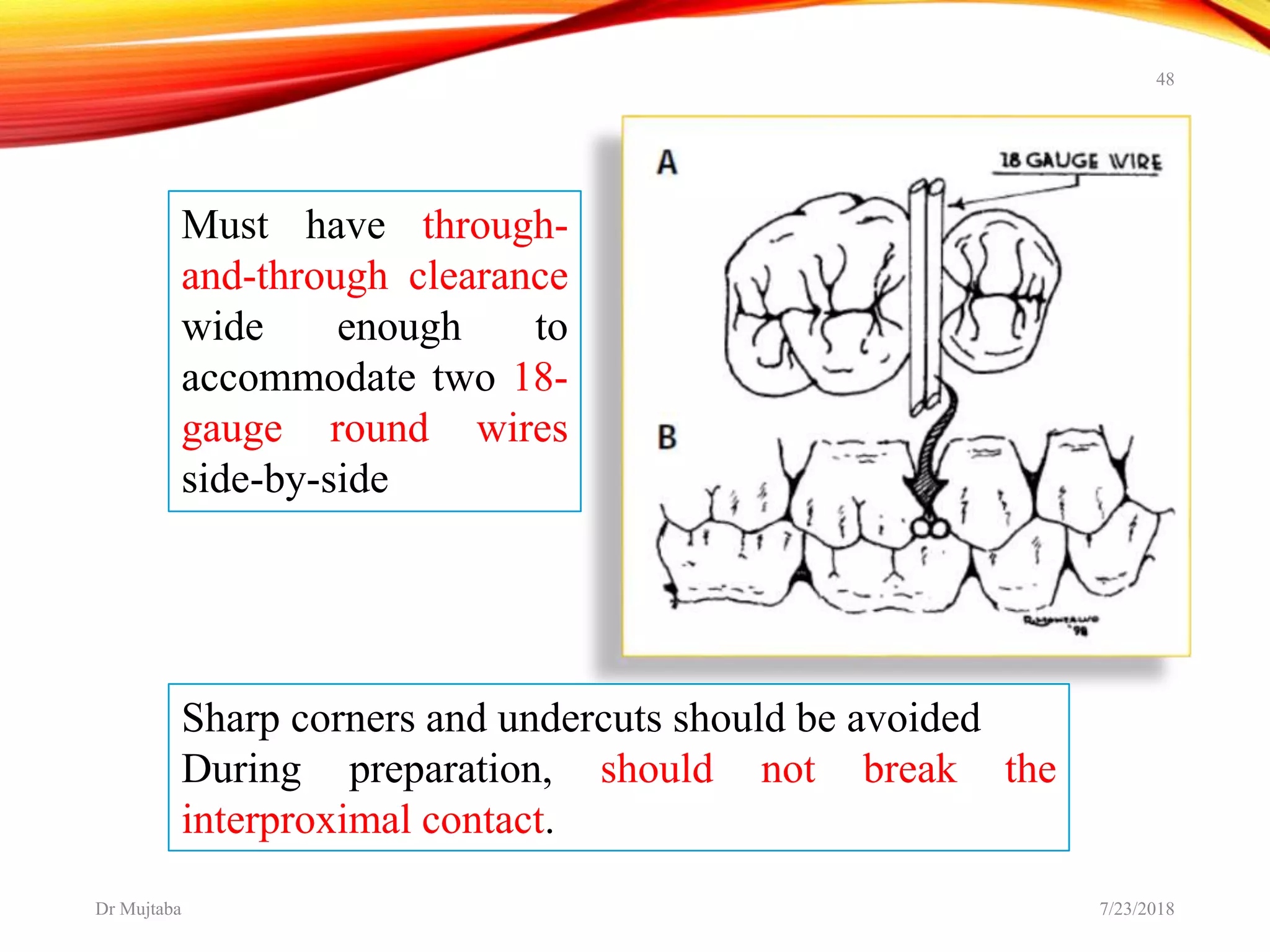 Preparation of abutment teeth | PPTX