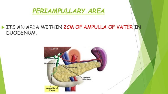 Preparation of a patient of obstructive jaundice and periampullary ca…