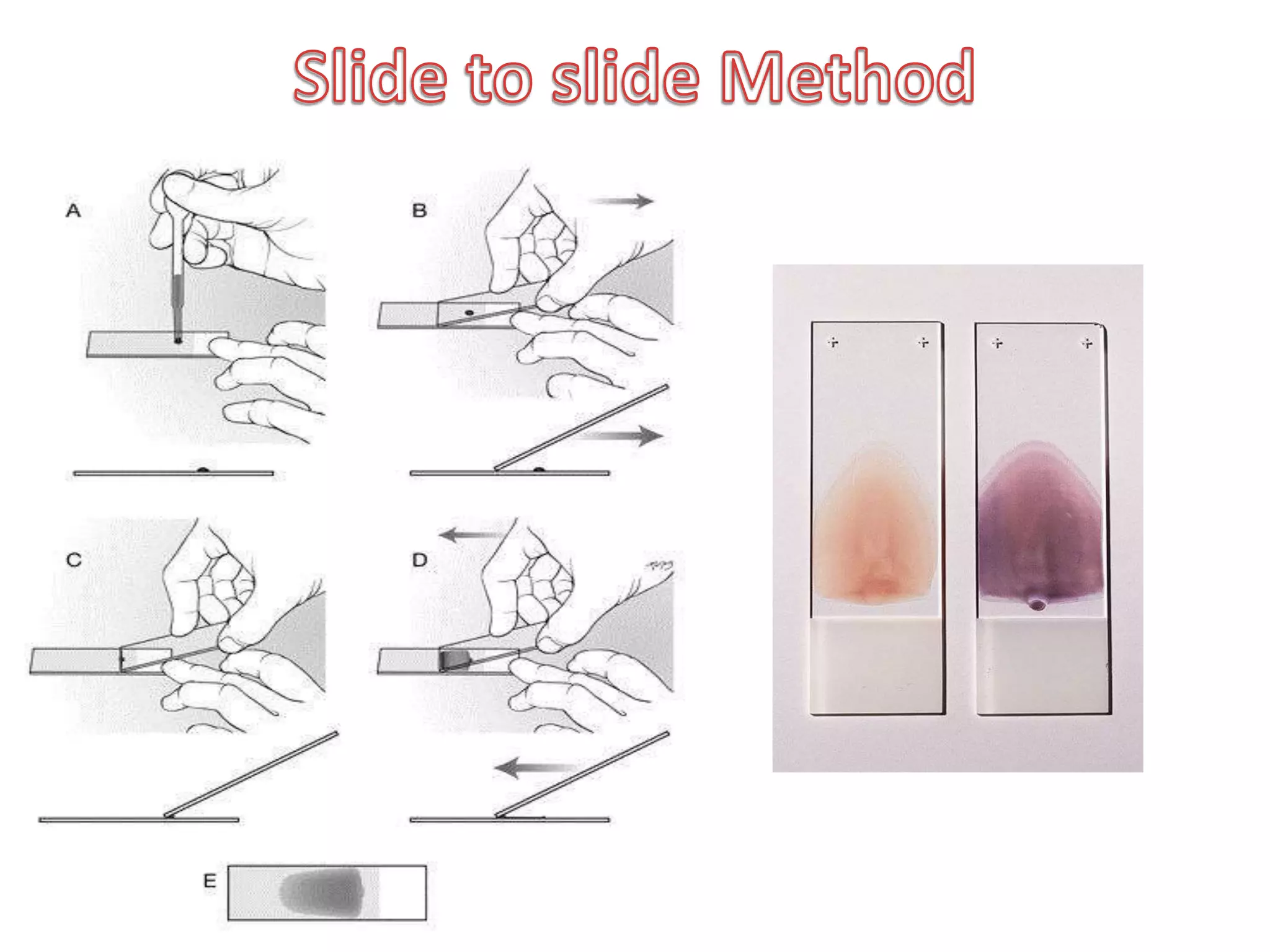 Preparation of blood smear | PPSX