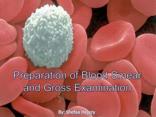 Preparation of blood smear | PPSX