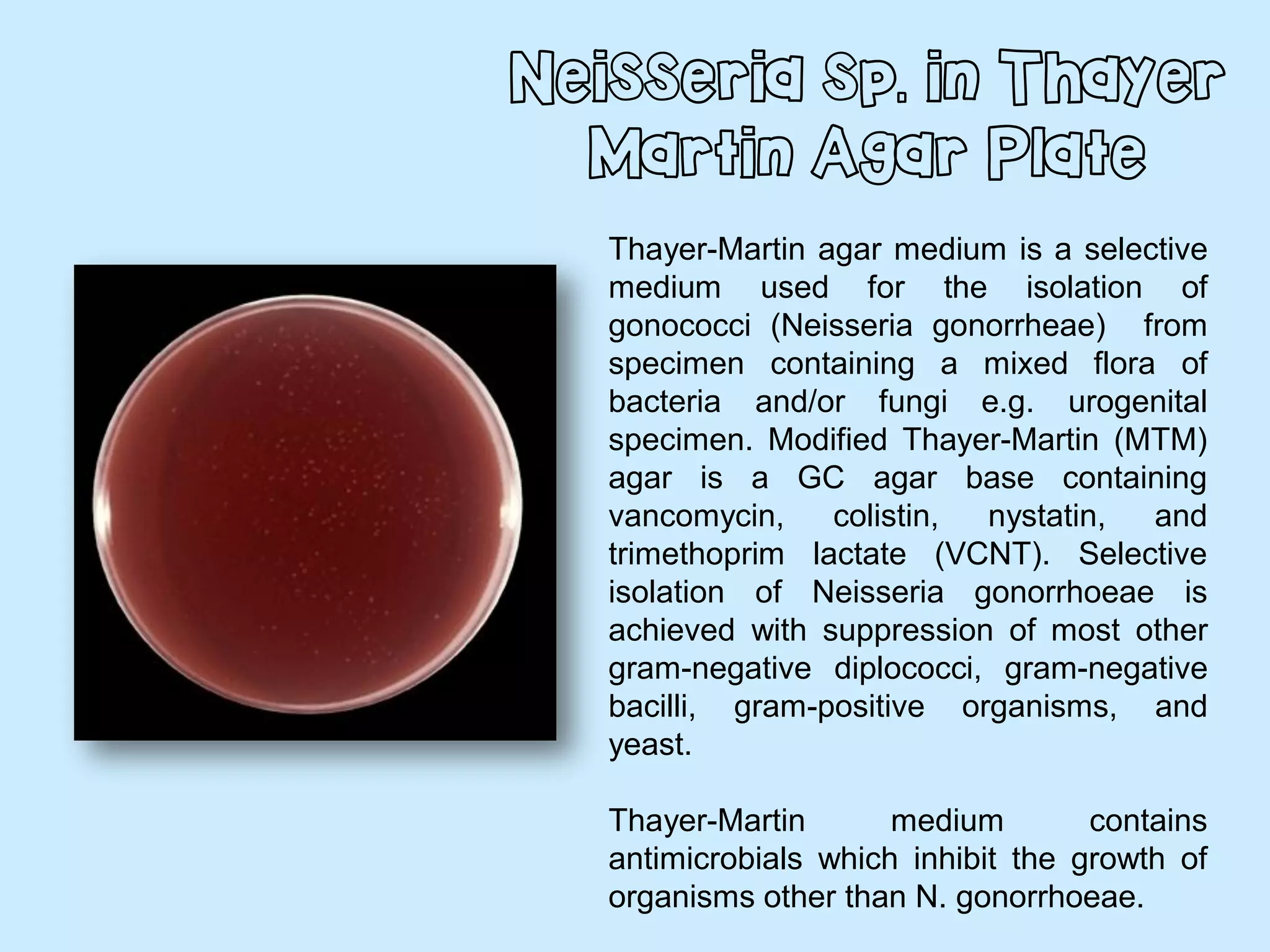 Preparation of culture media and cultivation of microorganism | PDF