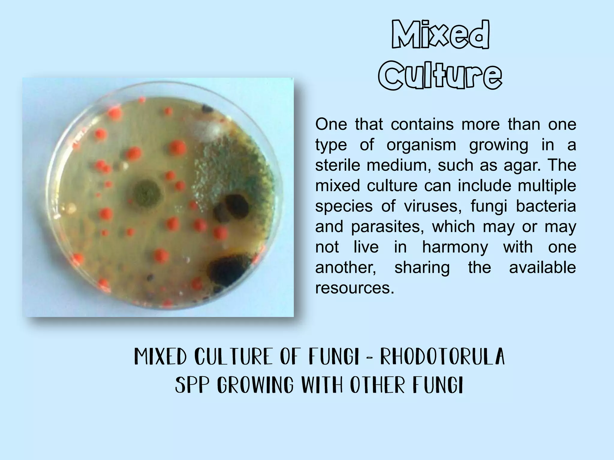 Preparation of culture media and cultivation of microorganism | PDF