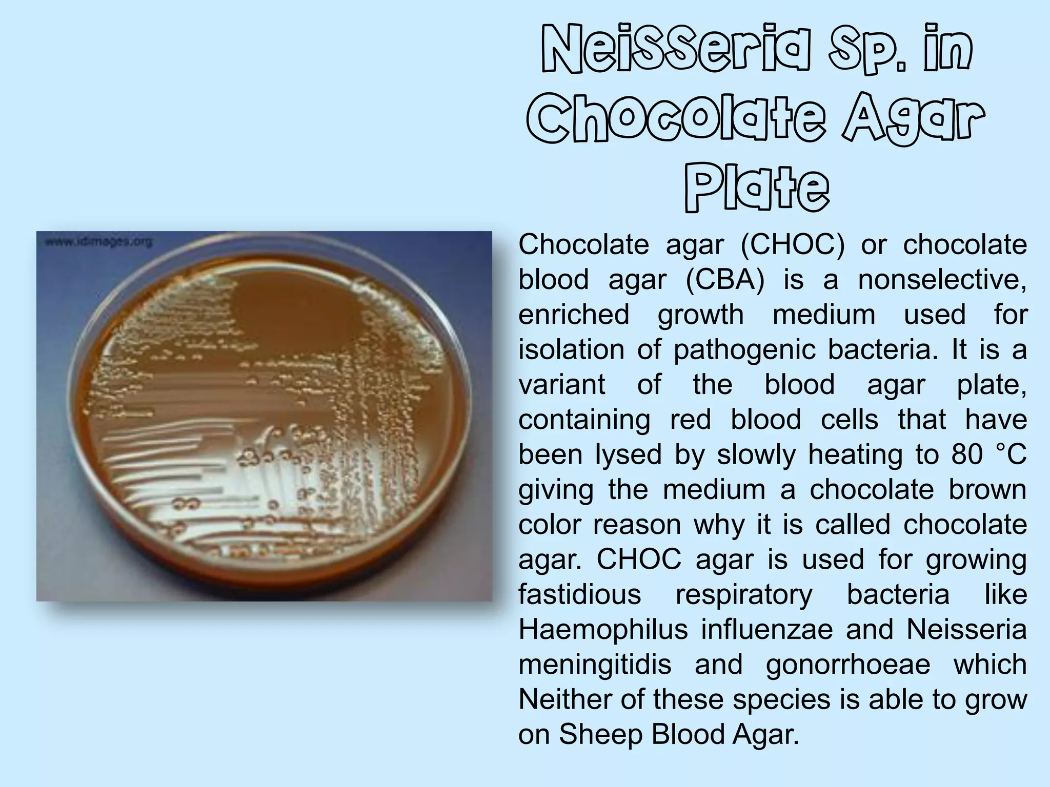 Preparation of culture media and cultivation of microorganism | PDF