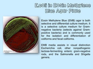 Preparation of culture media and cultivation of microorganism | PDF