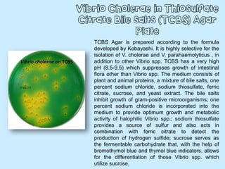 Preparation of culture media and cultivation of microorganism | PDF