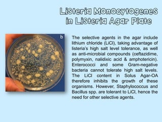 Preparation of culture media and cultivation of microorganism | PDF