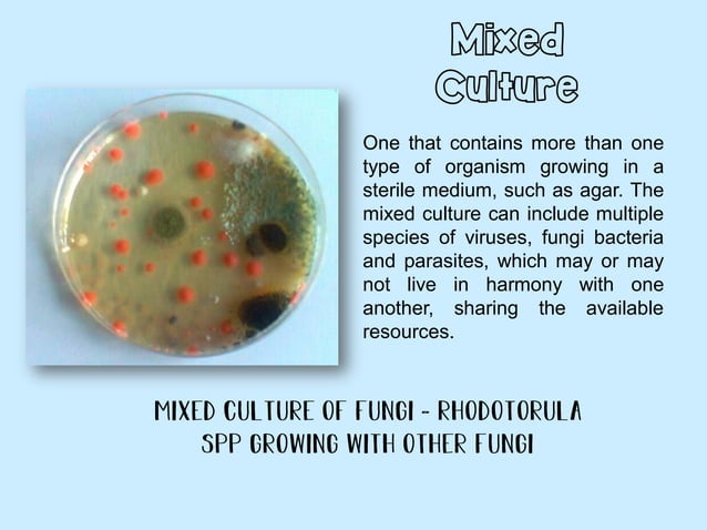 Preparation of culture media and cultivation of microorganism | PDF ...