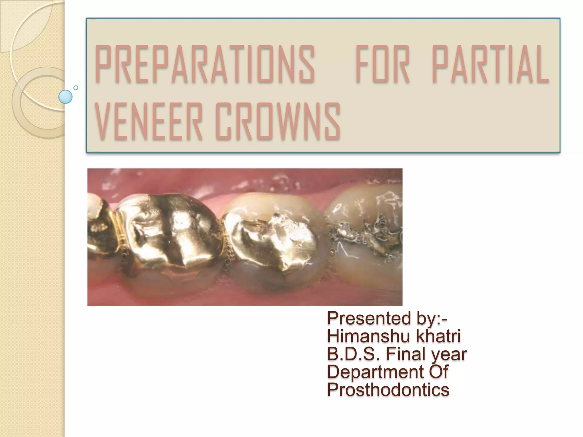 Preparation of partial veneer crown | PPTX