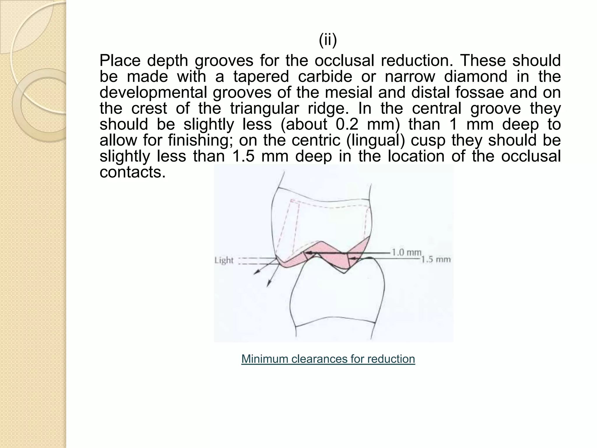 Preparation of partial veneer crown | PPTX