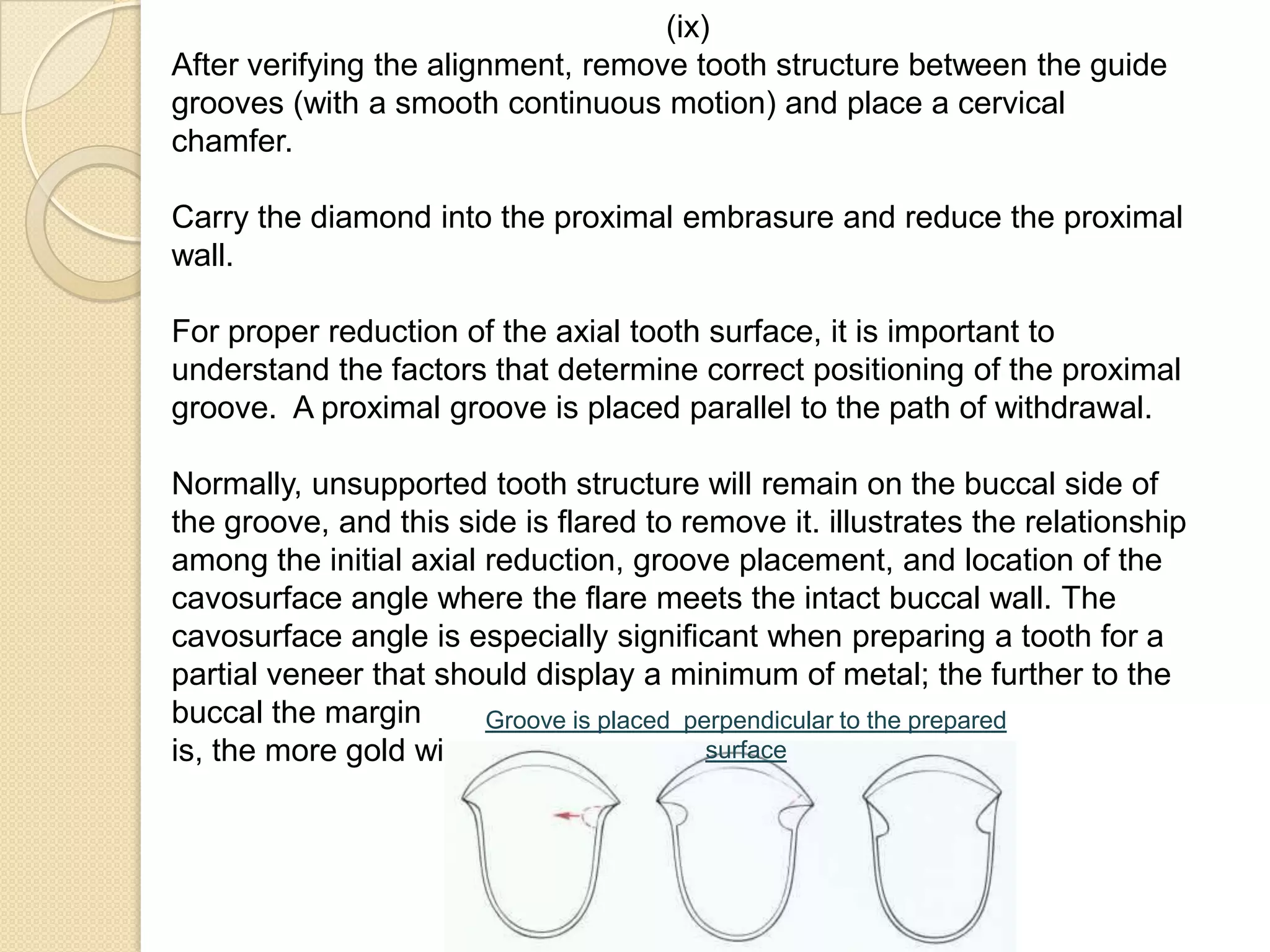 Preparation of partial veneer crown | PPTX