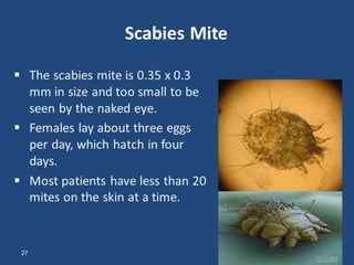 Preparation of sulphur ointment | PPTX
