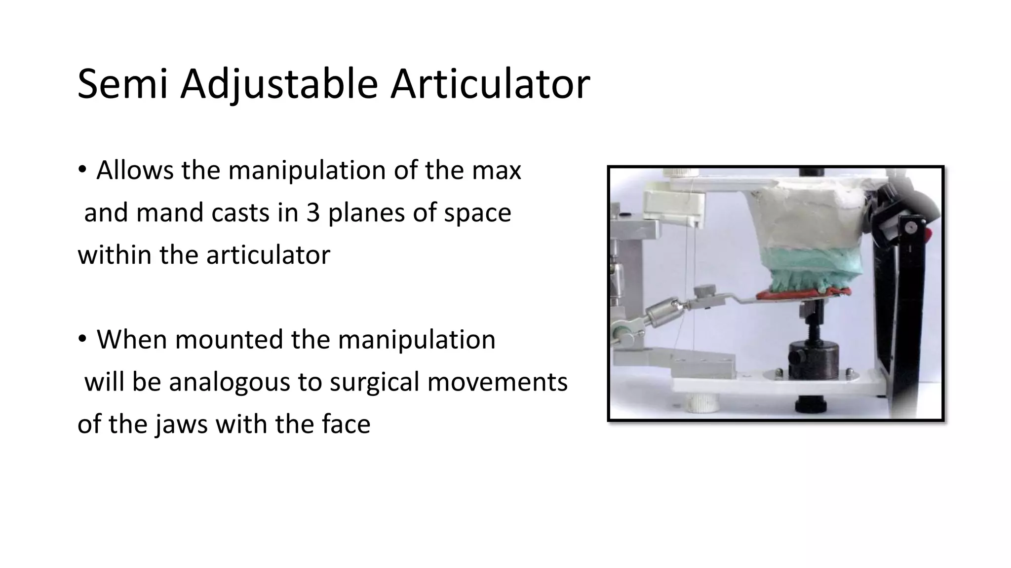 Preparation of surgical splints in bi jaw surgery | PPTX