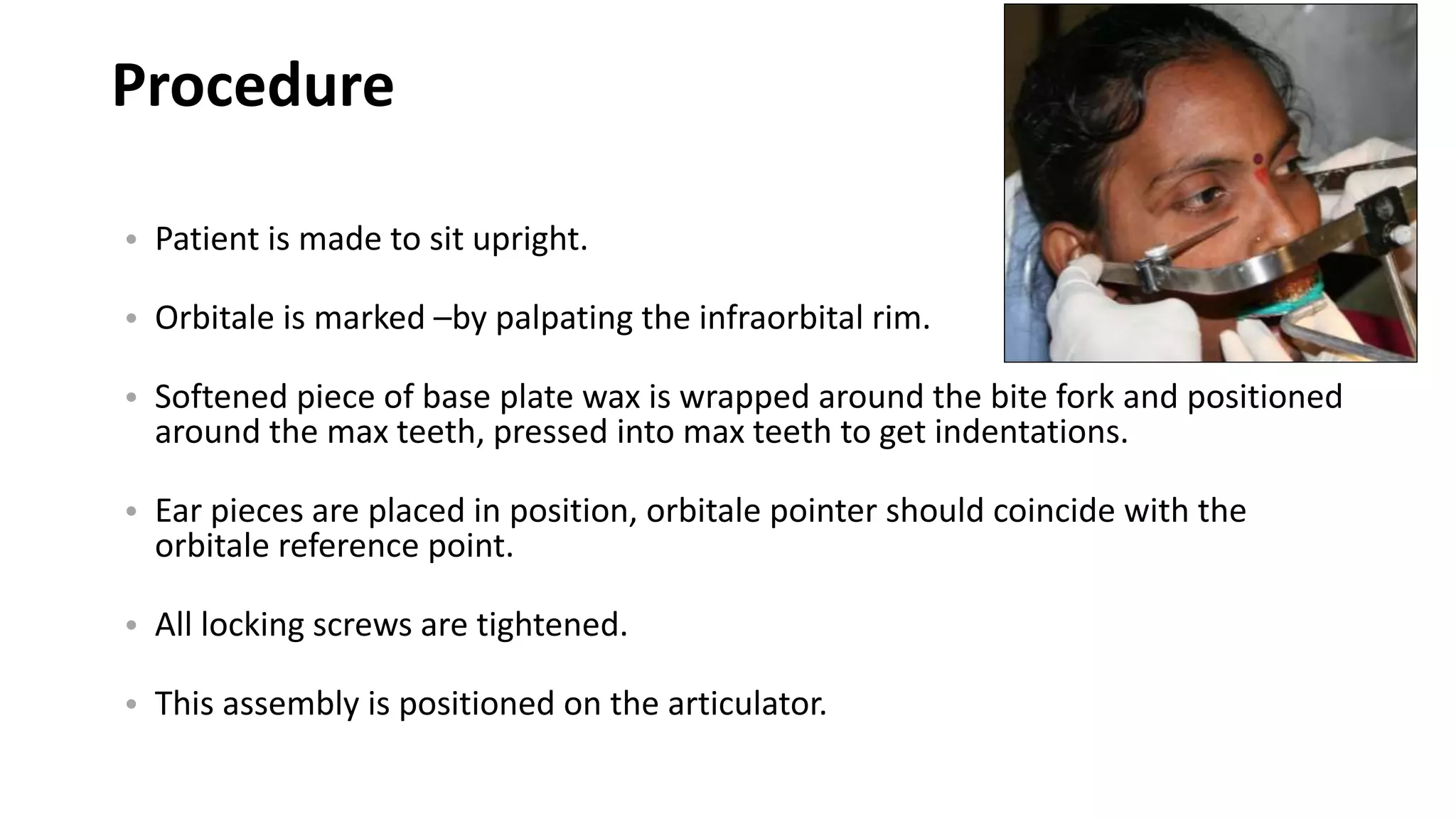 Preparation of surgical splints in bi jaw surgery | PPTX