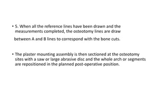 Preparation of surgical splints in bi jaw surgery | PPTX