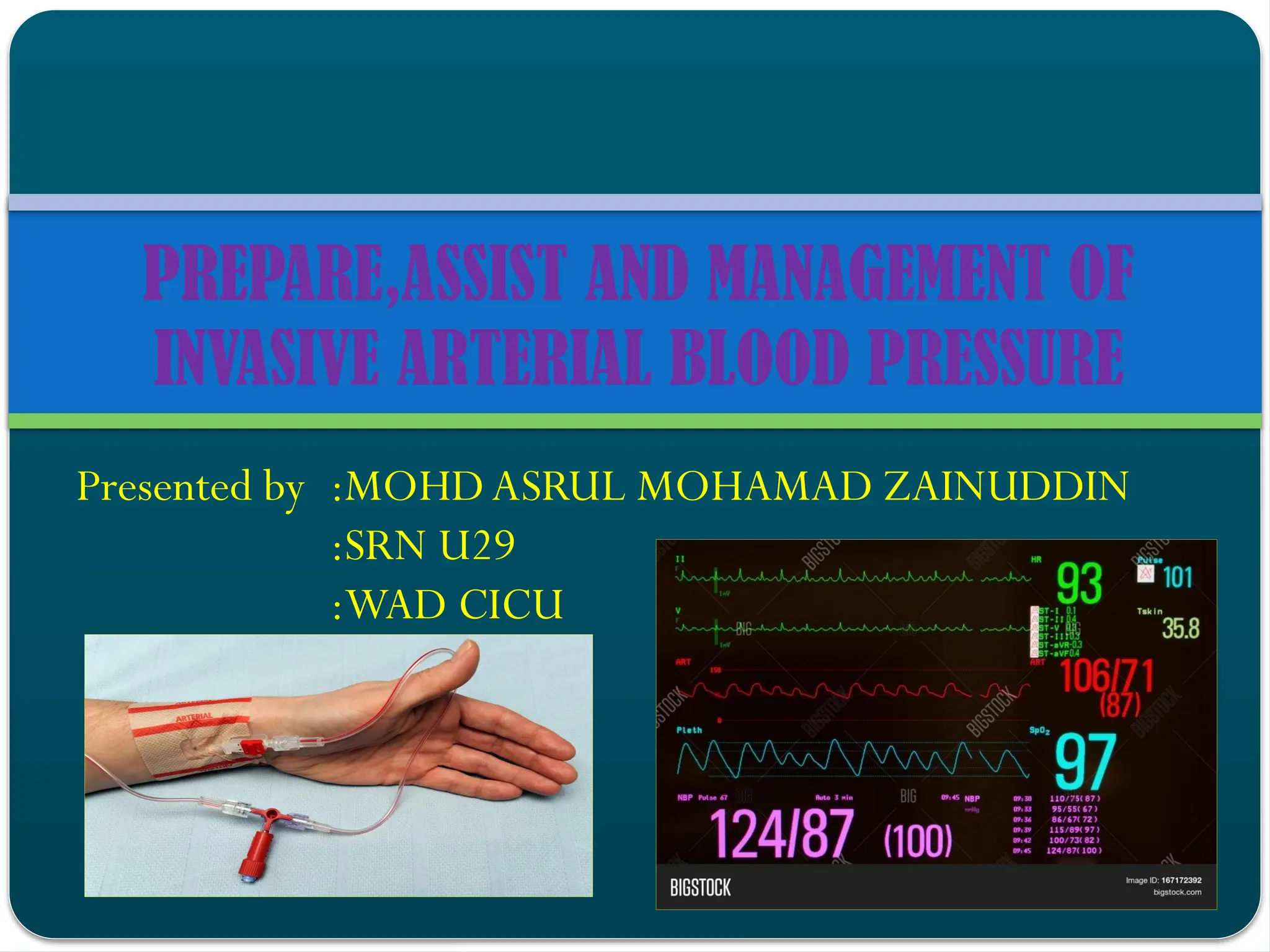 PREPARE,ASSIST AND MANAGEMENT OF INVASIVE ARTERIAL BLOOD PRESSURE.pptx