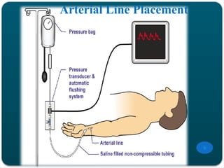 PREPARE,ASSIST AND MANAGEMENT OF INVASIVE ARTERIAL BLOOD PRESSURE.pptx