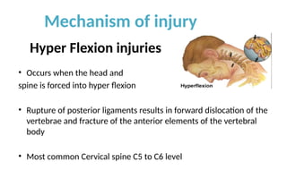 Spinal cord injury Prepared by Eyob and Nejimudin PTI.pptx