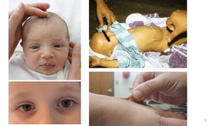 Prepare ORS from ORS packet and explain its use | PPTX