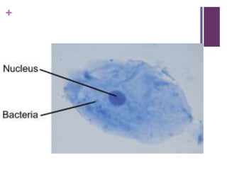 Preparing a cheek cell slide | PPTX