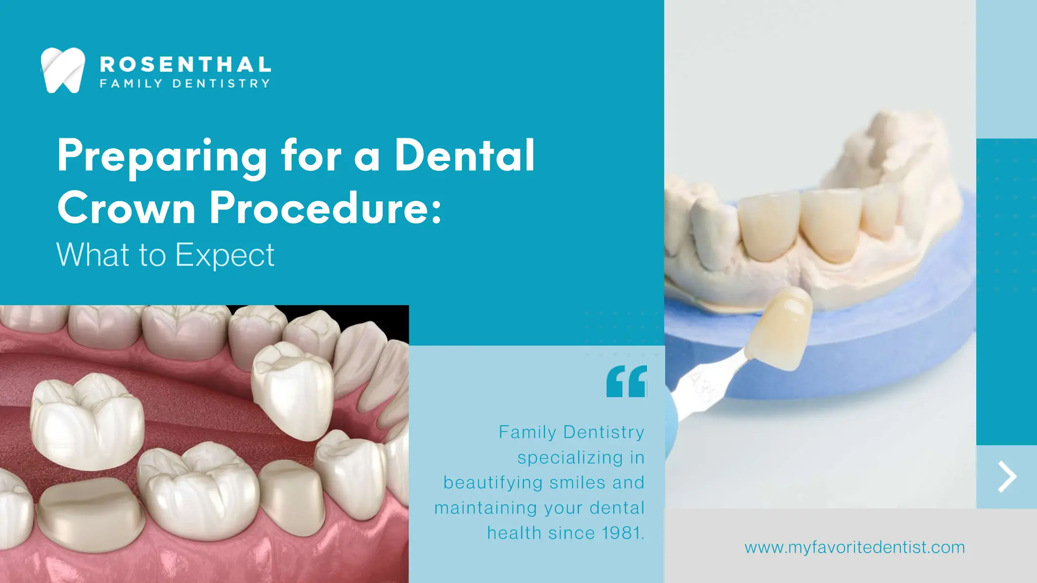 Preparing for a Dental Crown Procedure What to Expect.pptx
