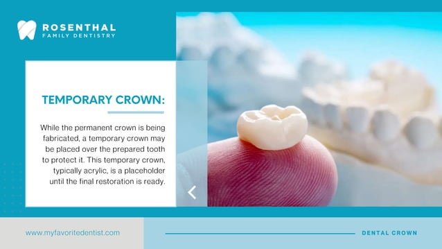 Preparing for a Dental Crown Procedure What to Expect.pptx
