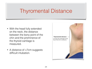 Anesthetic preparations for surgery | PDF