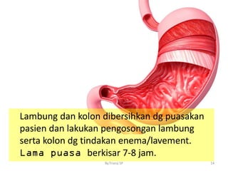 Pre post operasi | PDF