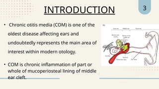 PRE & POST OPERATIVE STATUS OF CONTRALATERAL EAR IN UNILATERAL CSOM 6.pptx