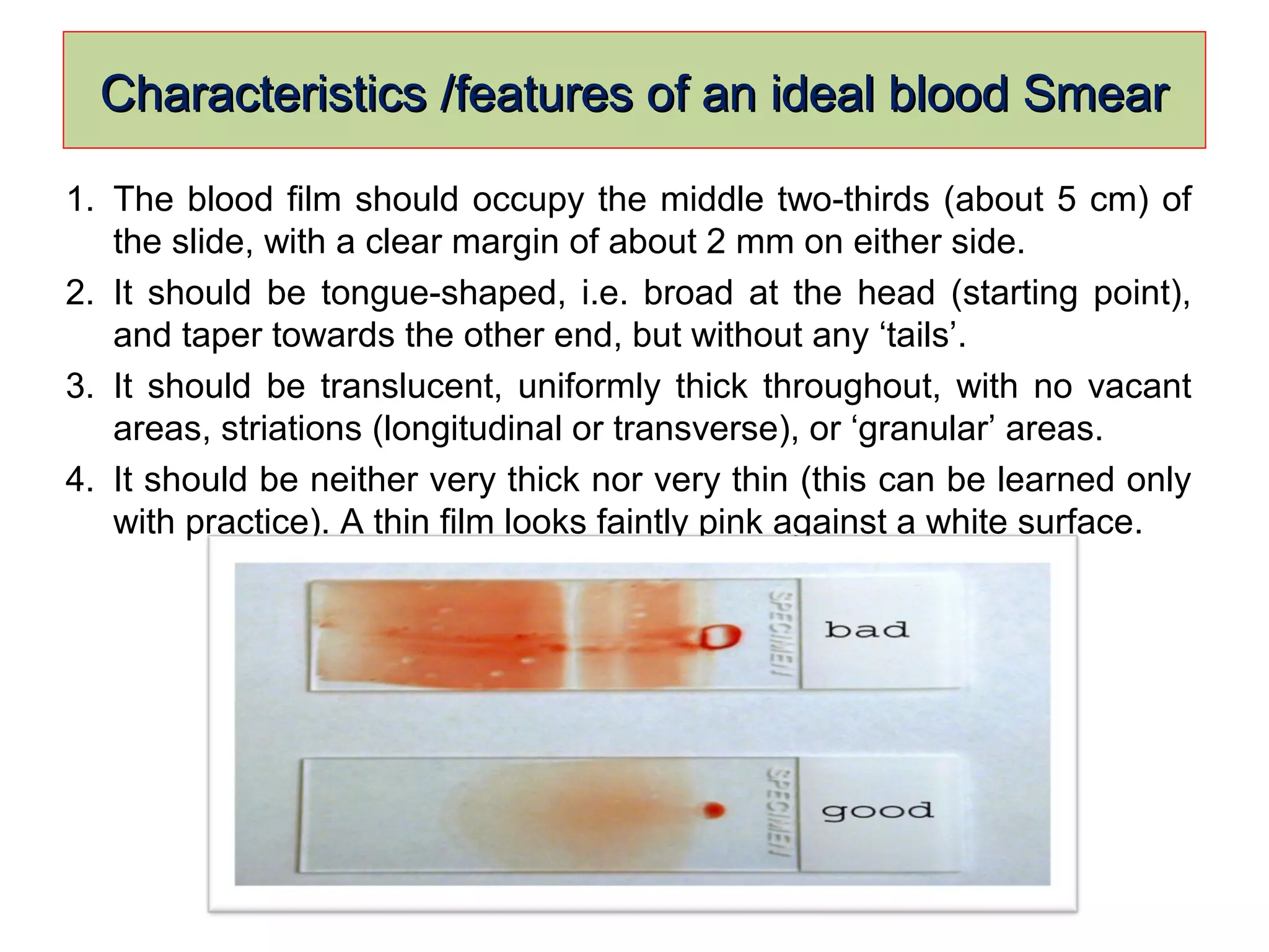 Prepration and staining of blood film | PPT