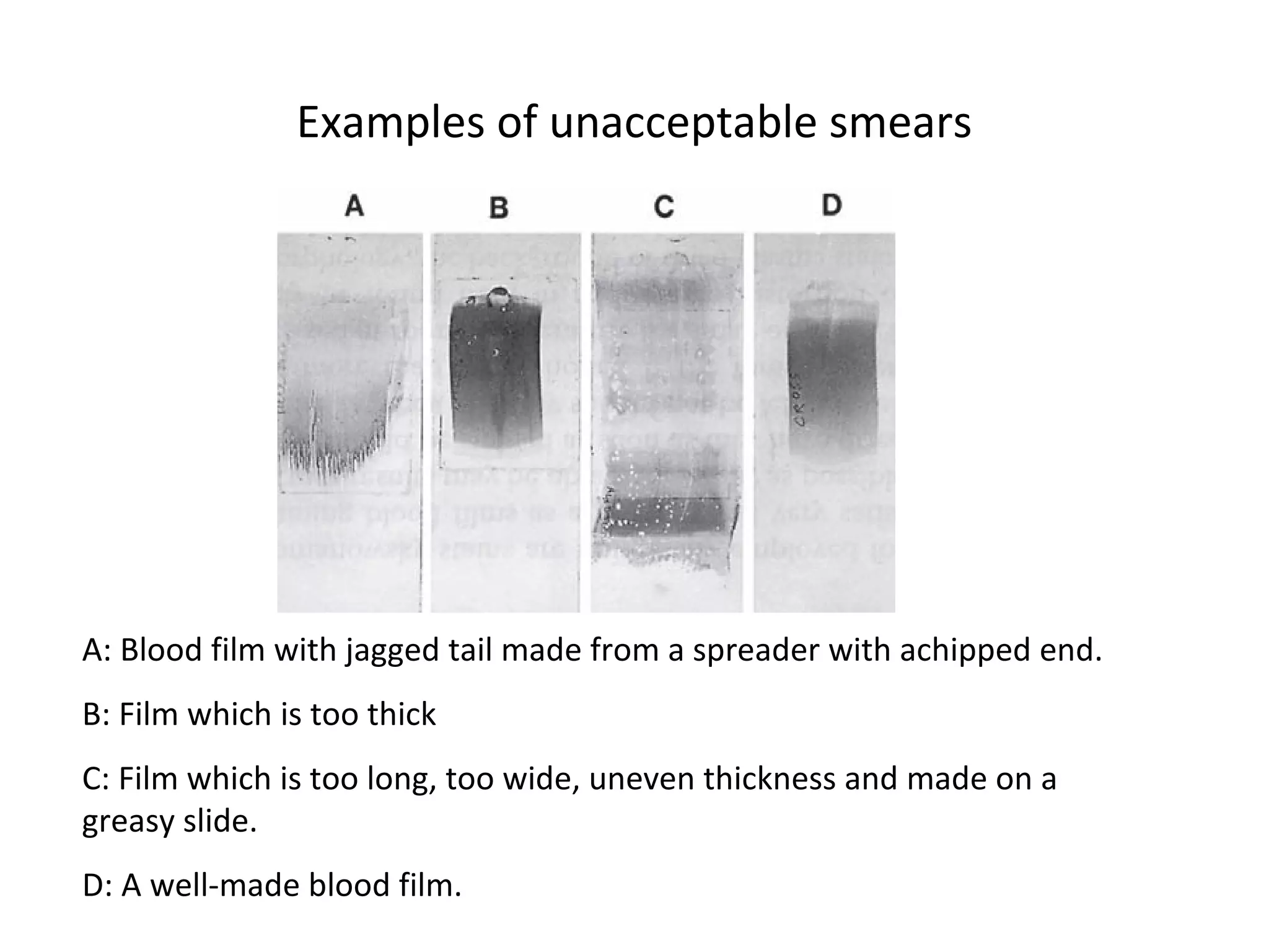 Prepration and staining of blood film | PPT